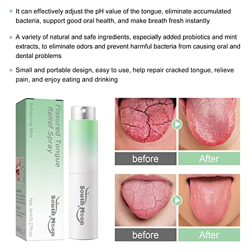 2Pc Fissured Tongue Relief Spray, Breath Freshener Spray for Tongue Treatment