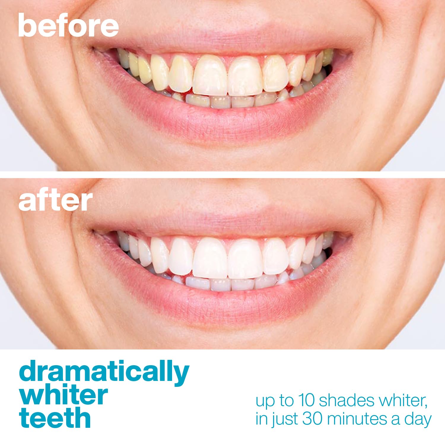AquaSonic Professional Teeth Whitening Strips - Enamel Safe Teeth Whitening with Hydrogen Peroxide - Easy to Use, Non-Slip, Affordable & Effective (Unflavored)