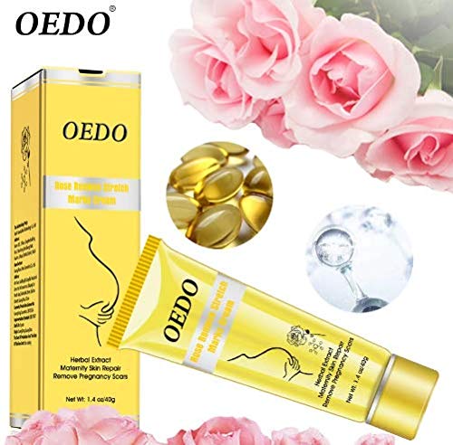 1pcs Remove Stretch Marks Cream Anti Wrinkle Anti Aging Maternity Skin Repair Remove Pregnancy Scars Treatment Body Skin Care
