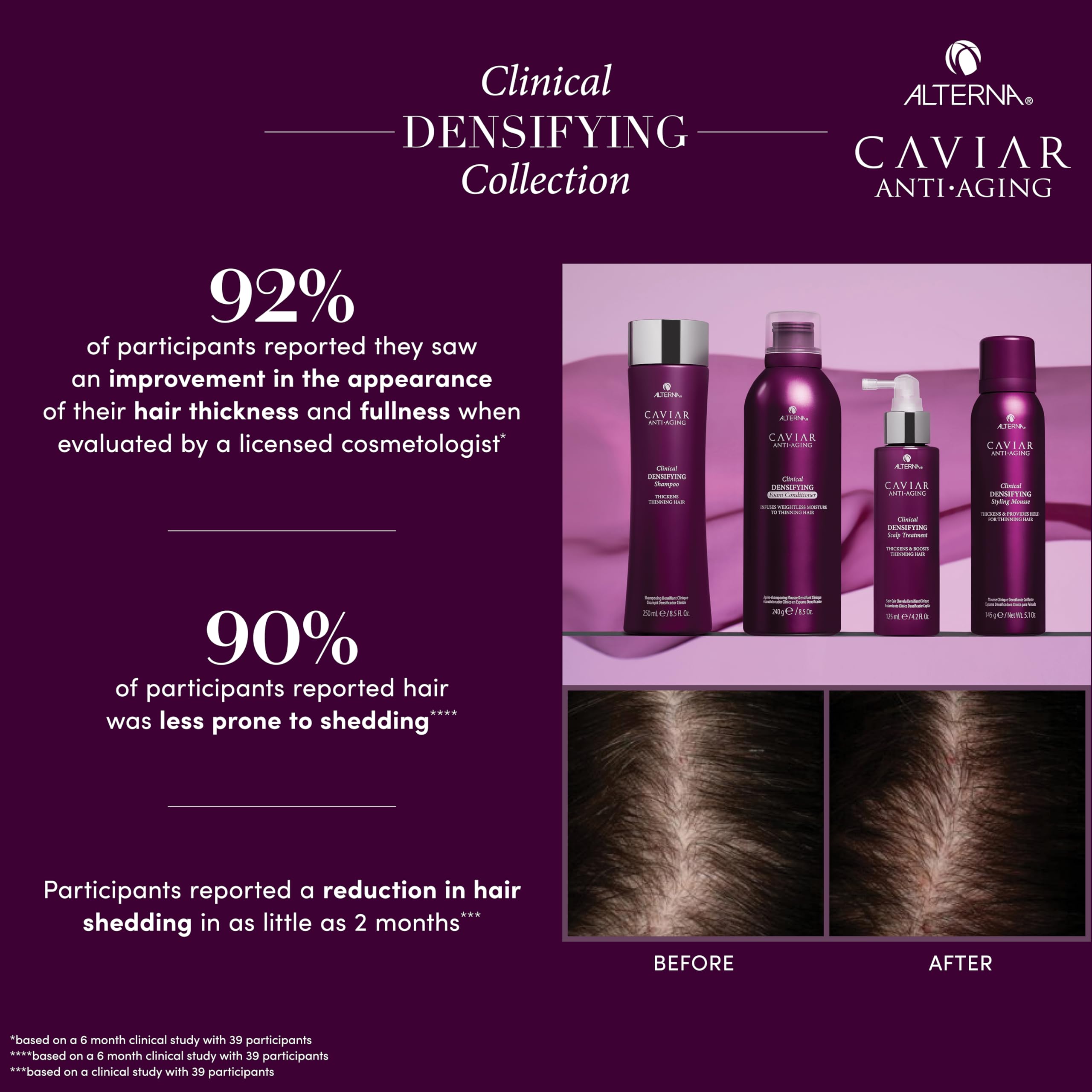 CAVIAR Anti-Aging Clinical Densifying Shampoo 8.5 Fl Oz | For Fine, Thinning Hair | Thickens Hair, Protects Scalp | Sulfate Free
