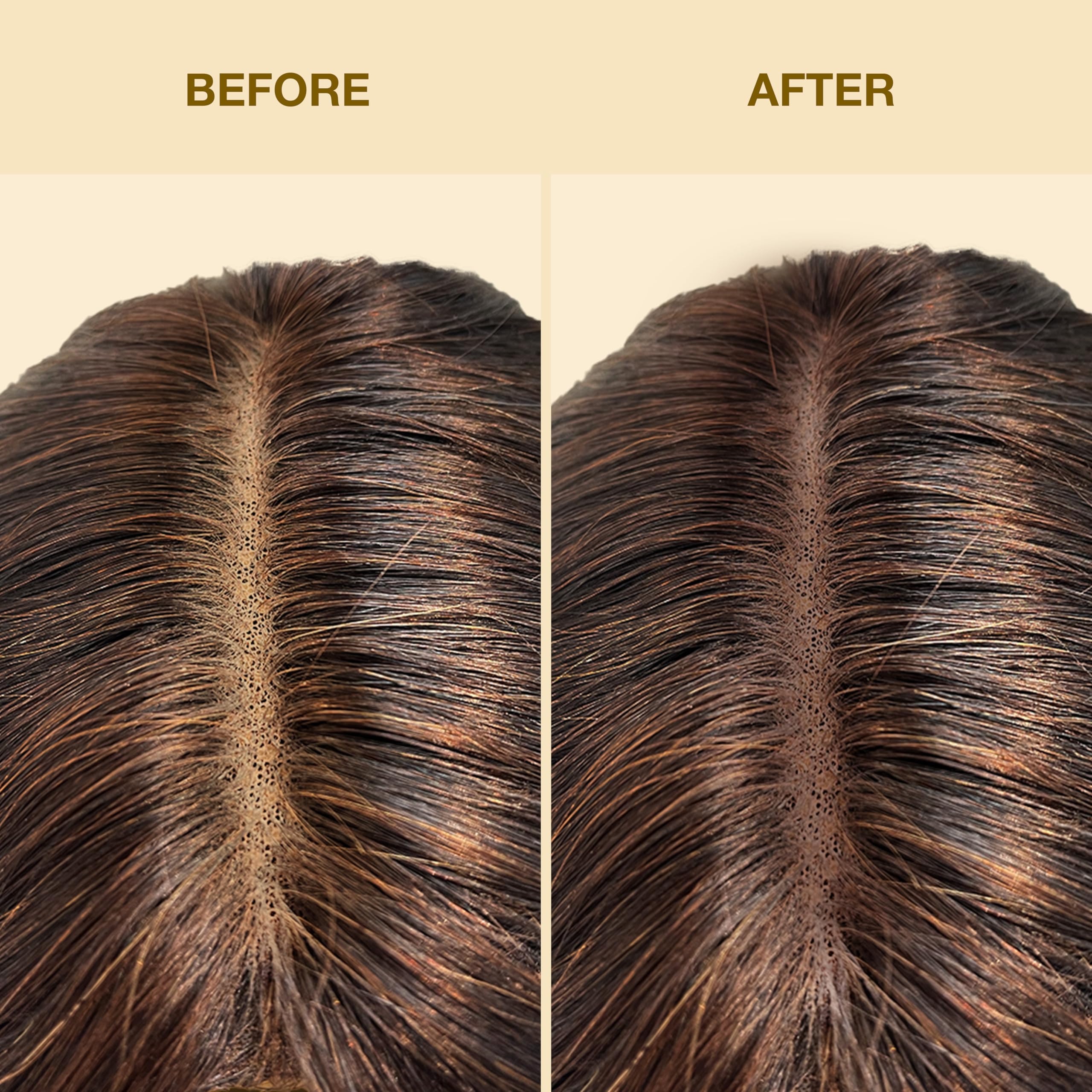 EBIN NEW YORK Tinted Lace Spray - Medium Brown 2.7oz/ 80ml, Quick dry, Water Resistant, No Residue, High pigmentation, Even Spray, Matching Skin Tone, Natural Look, Tinted Spray for Wig