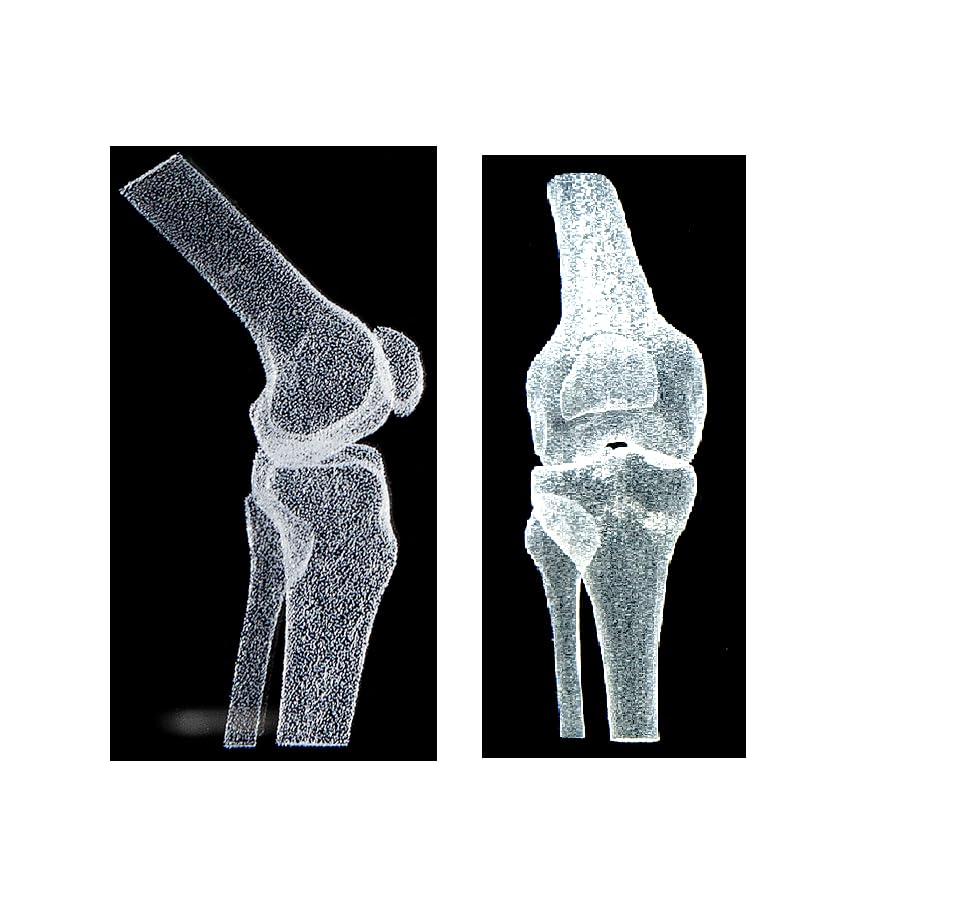 Blue Tree Publishing Knee Joint 3d Laser Key Chain Crystal, Anatomy, Bone, Physical Therapy Sports