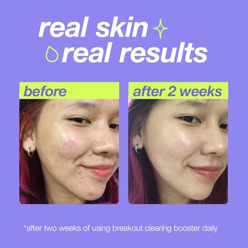 Dermalogica Clear Start Breakout Clearing Booster (1 Fl Oz) Acne Spot Treatment with Salicylic Acid - Clears Breakouts & Locks in Moisture To Soothe Irritation