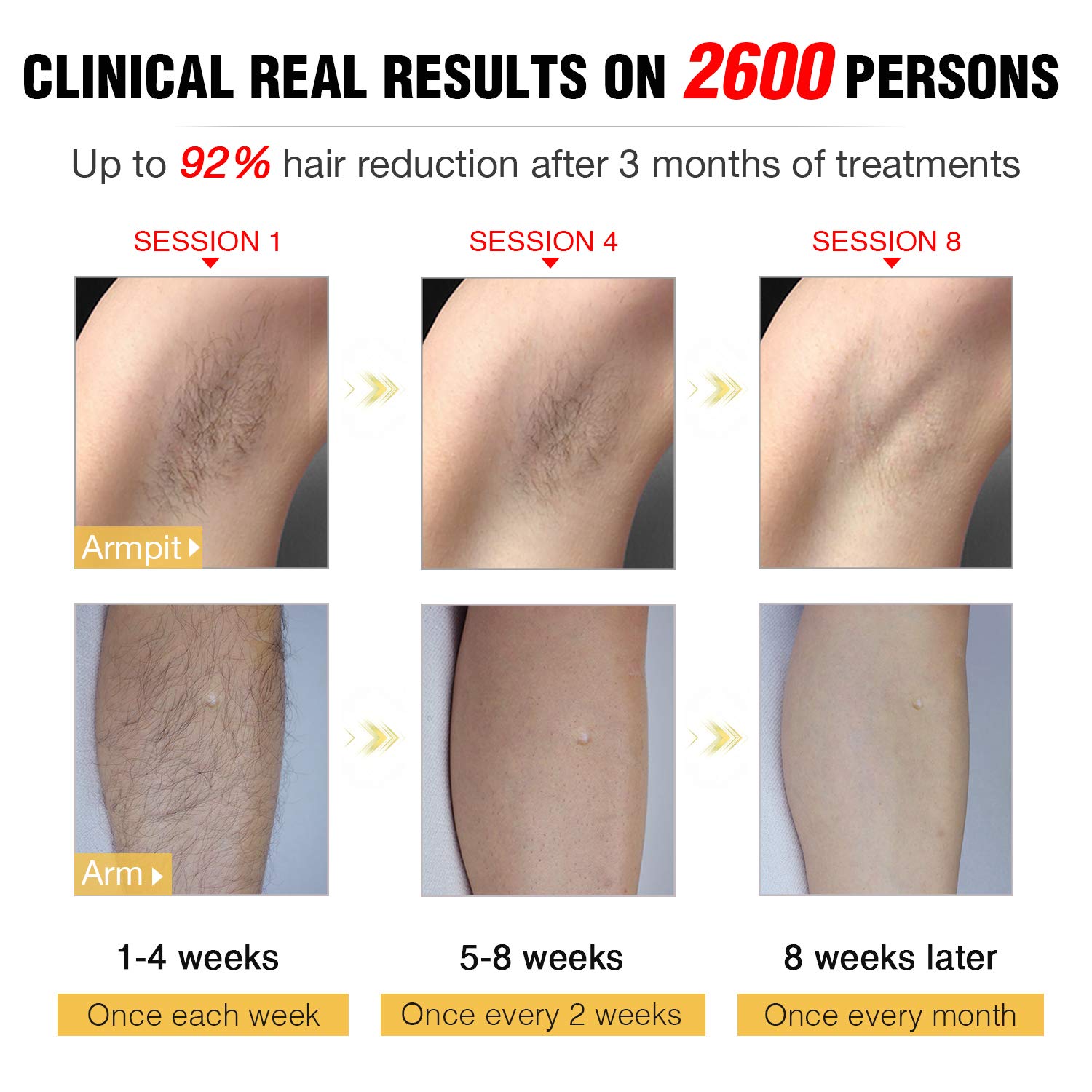 IMENE Painless IPL Hair Remover - Yellow (Ideal for Bikini, Legs, Arms, Armpits - Intense Pulsed Light Technology)
