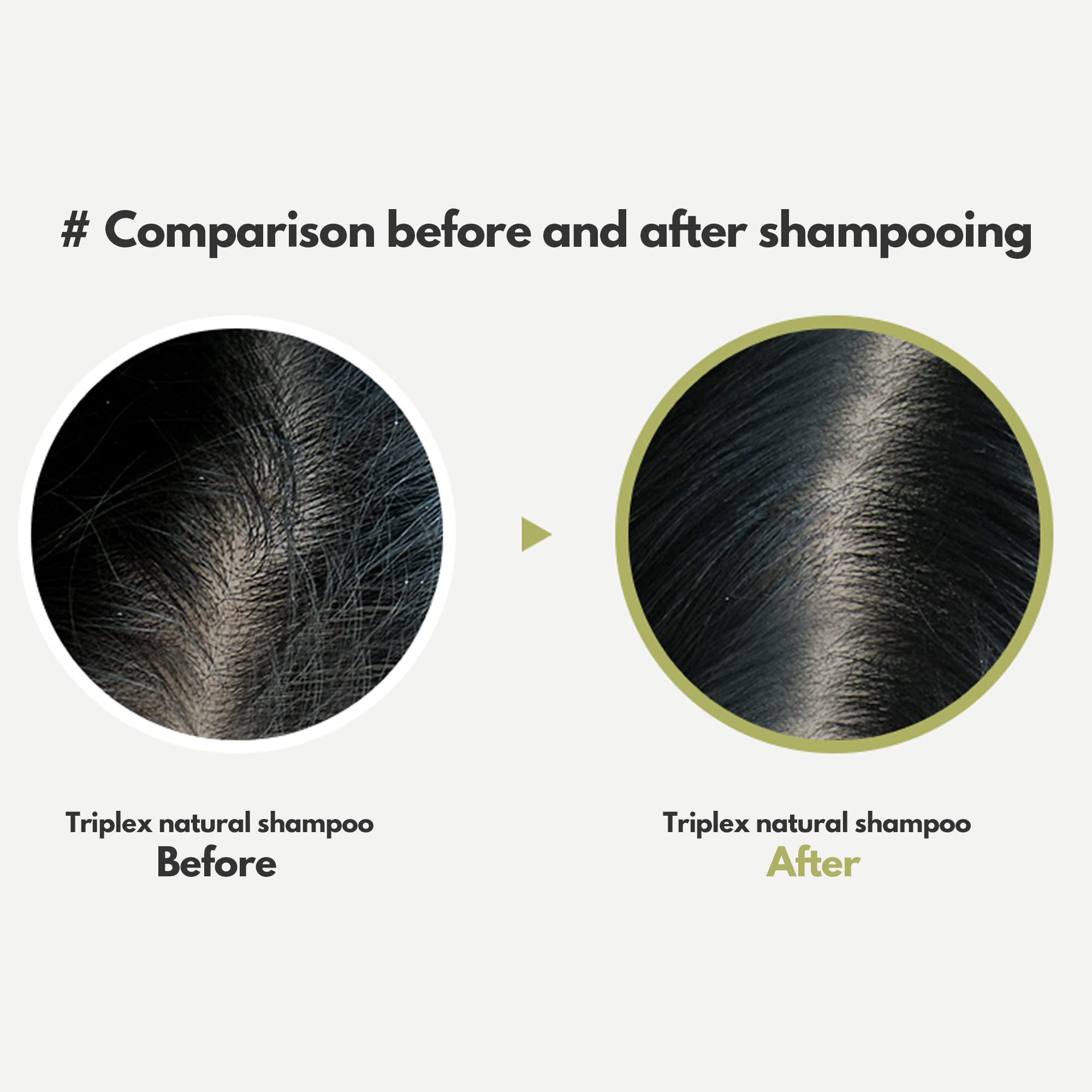 LA'DOR TripleX 3 Deep Cleansing Shampoo for Dry Itchy Sensitive Scalp Dandruff w/Tea Tree Lemon Lavender Sulfate-free Korean Hair Care 10 Fl Oz
