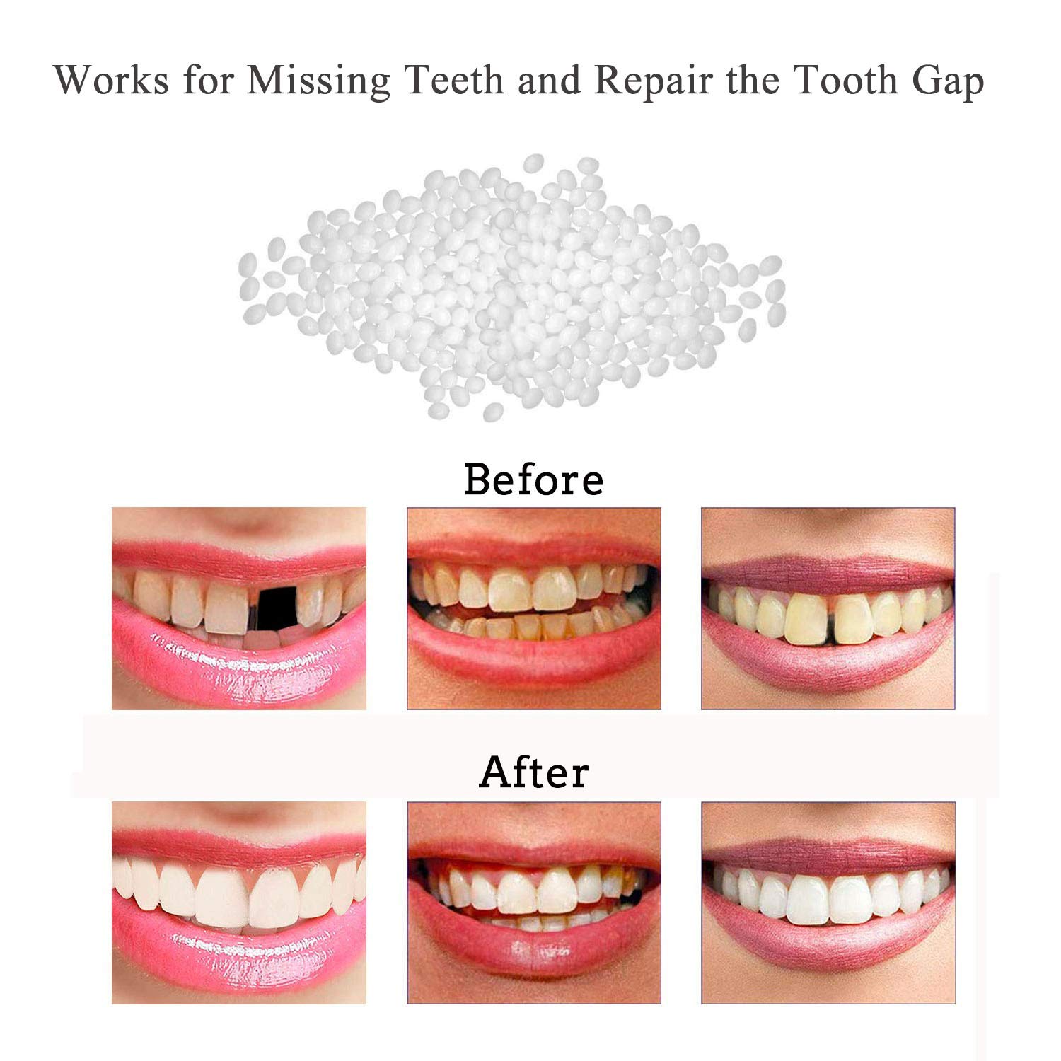 Tooth Repair Kit-Thermal Beads for Filling Fix The Missing and Broken Tooth or Adhesive The Denture Fake Teeth