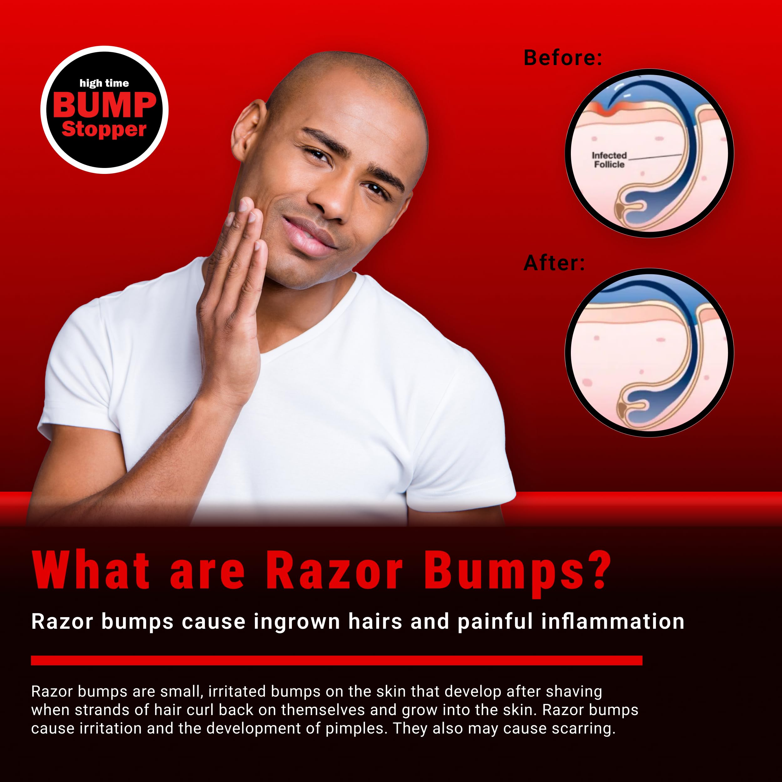 Bump Stopper 2 Double Strength Razor Bump Treatment | Formulated to Relieve Razor Burn | Eliminates Ingrown Hairs | Aftershave For Men - 0.5 OZ