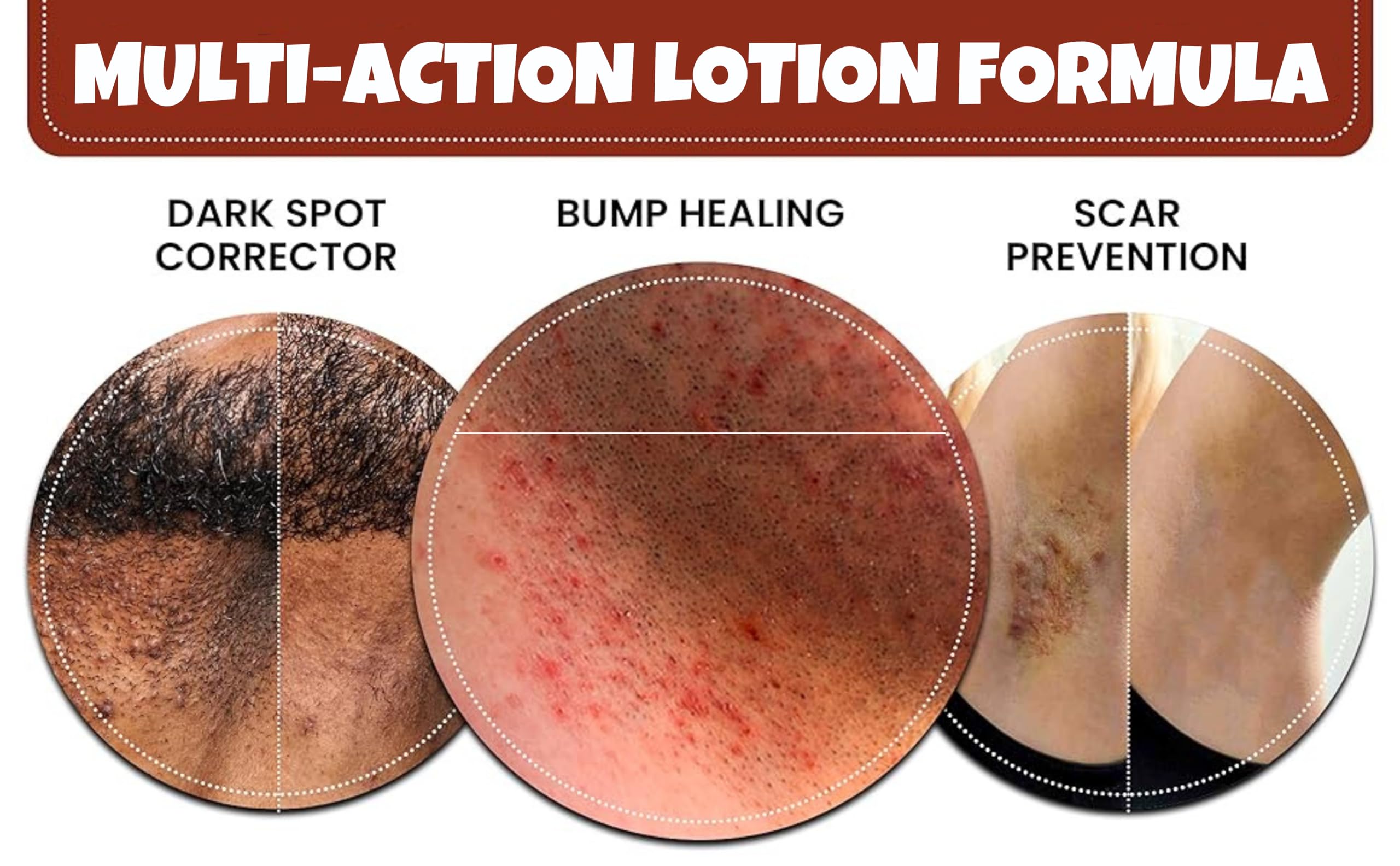Bump Zapper Anti Bump Soothing Lotion