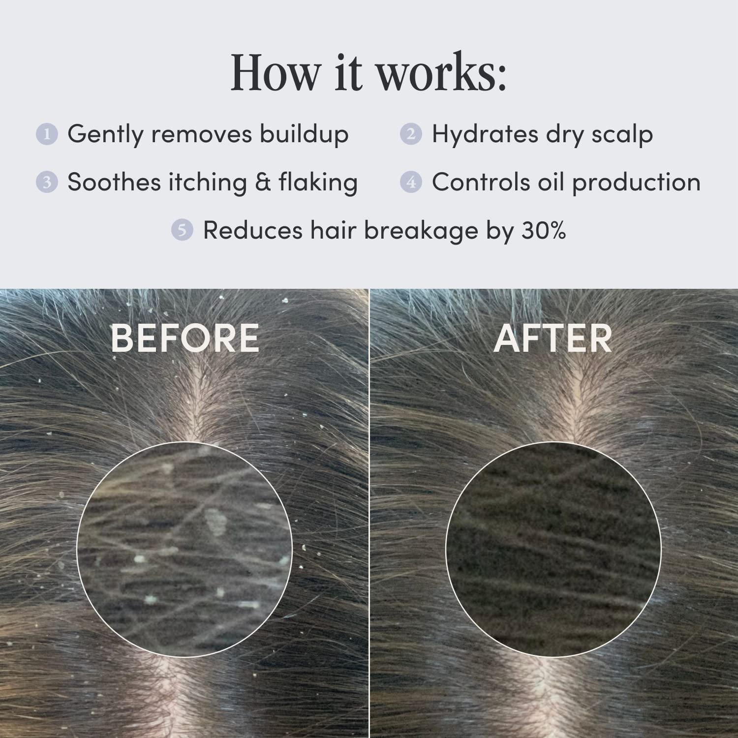 Jupiter Dandruff Shampoo, Conditioner, and Serum Trio, Relieves Itchy, Dry, & Flaky Scalp, Color-Safe, & Sulfate-Free, Made with Zinc, Coconut Oil, and Green Tea