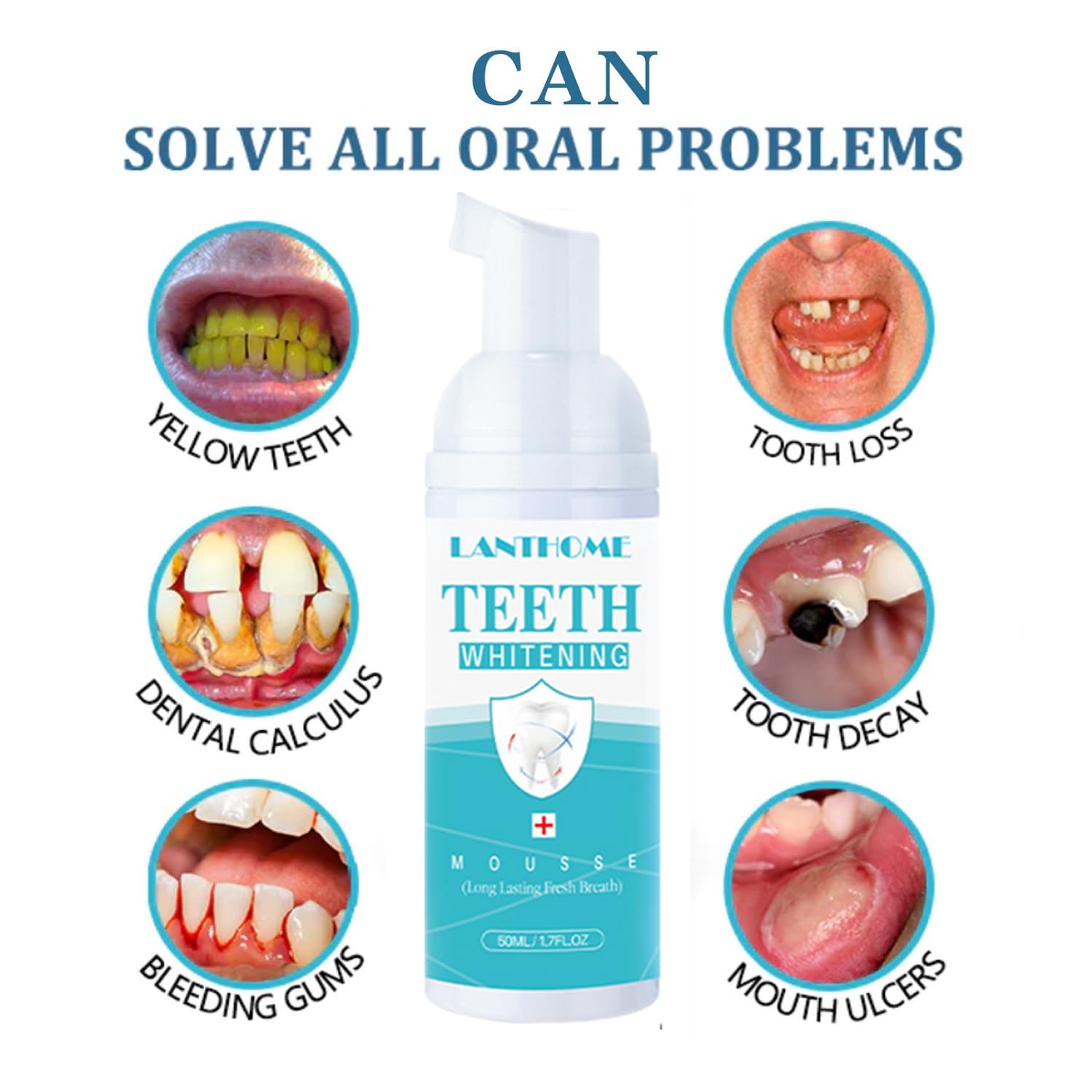 3PCs Teeth Whitening Mouthwash, Calculus Removal, Healing Mouth Ulcers, Eliminating Bad Breath, Prevents and Treats Cavities,Tooth Regeneration(50ml)