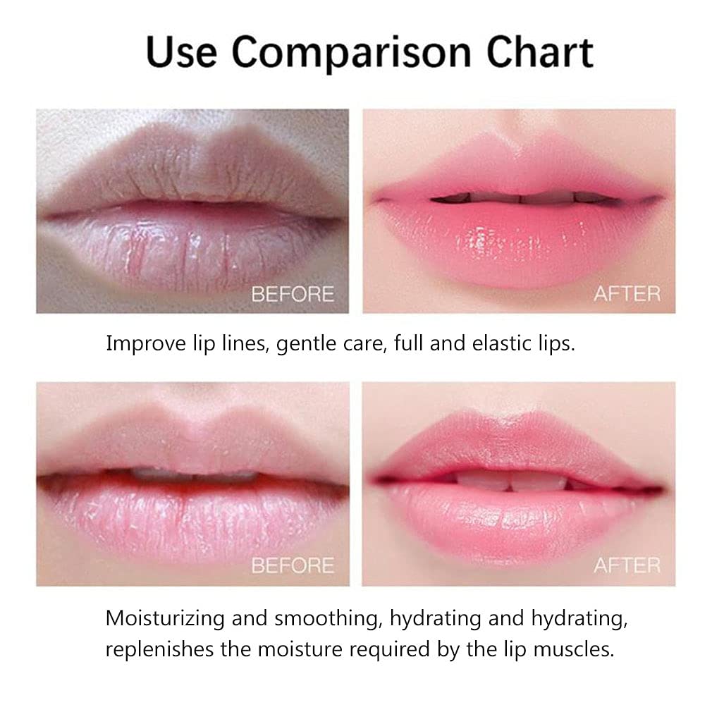 20Pcs Moisturizing/Plumping Lip Mask, Restores Moisture Mask for Dry Lips and Lines Overnight Care, Gel Treatment Masks (Pink)