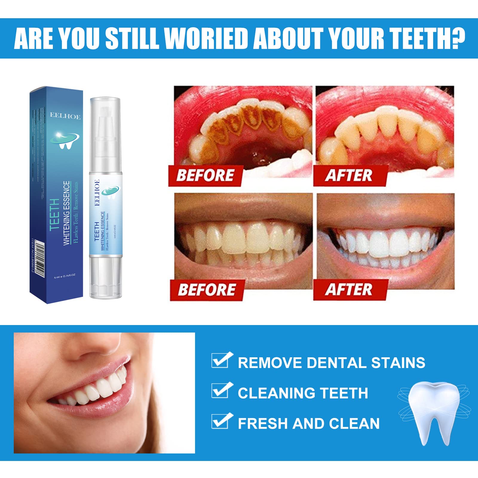 2Pcs LANTHOME Teeth Whitening Essence, Teeth Whitening Essence Pen Lanthome, Teeth Stain Remover to Whiten Teeth, Teeth Whitening Gel, Fast and Effective Removal Tooth Stain Removal