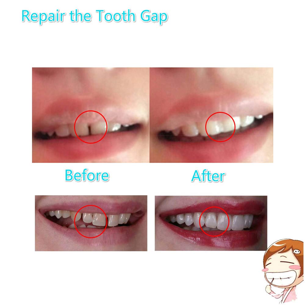 Multi-functional Temporary Tooth Repair Kit Moldable Thermal Fitting Beads for Snap On Instant and Confident Smile Denture Adhesive Fake Teeth Cosmetic Braces Veneer
