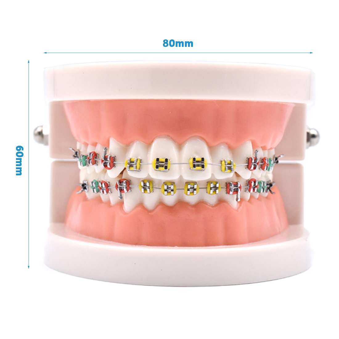 Angzhili 1 Piece Dental Demonstration Orthodontic Model with Metal Wires and Bracket (Metal bracket)