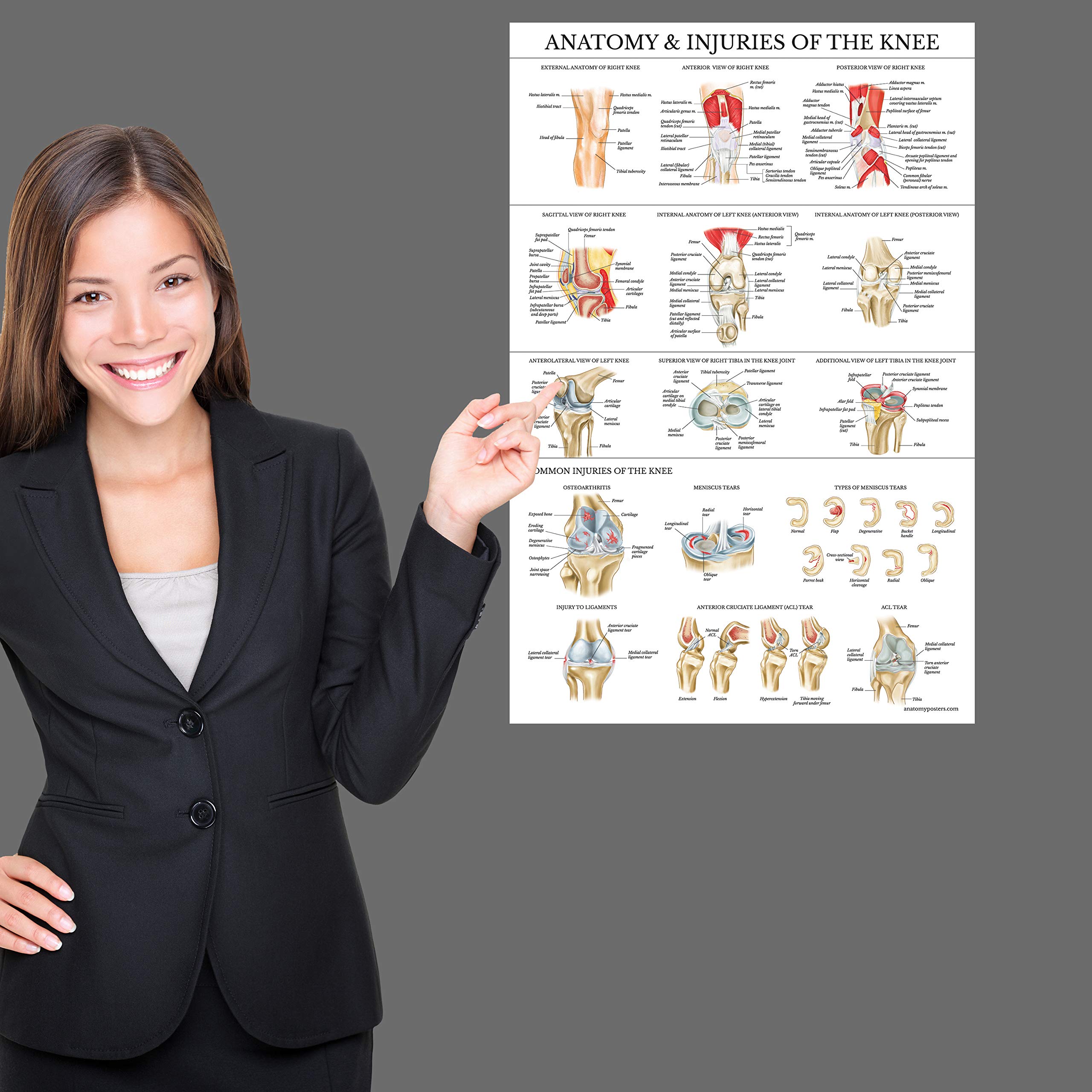 Palace Learning 2 Pack - Anatomy and Injuries of The Knee & Hip Poster Set - Anatomical Chart Set - Laminated 18" x 24"
