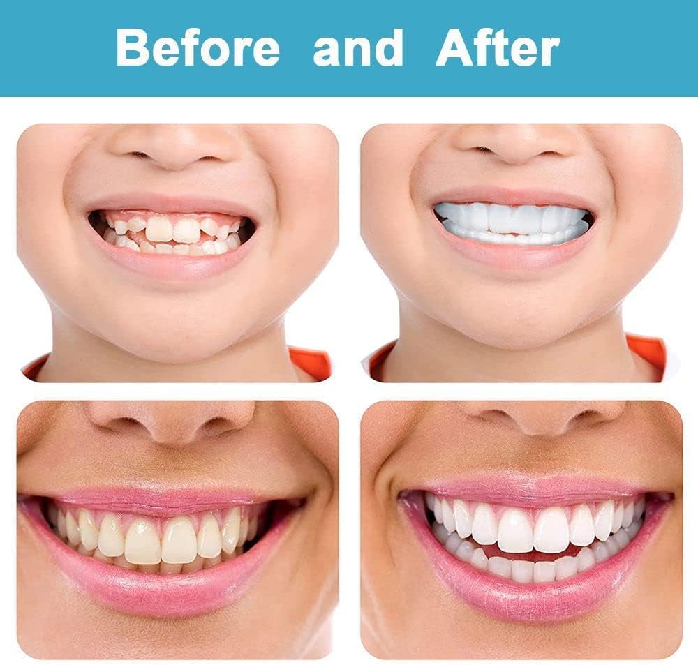 Fake Teeth, Instant Veneers for Temporary Tooth Repair Upper and Lower Jaw, Dentures Teeth Socket-Perfect for Women and Men, Protect Your Teeth and Regain Confident Smile, Natural Shape with Color