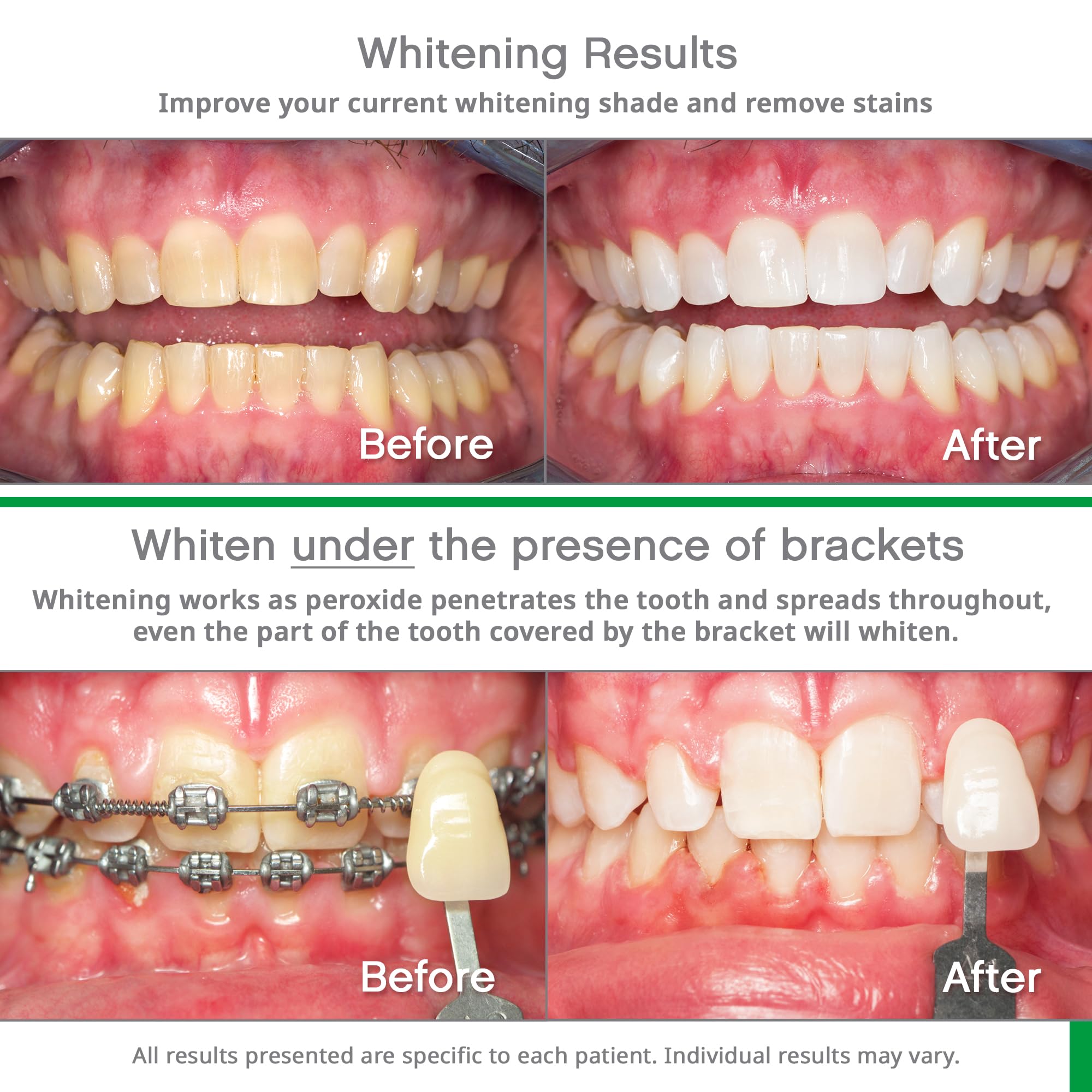 Opalescence GO 15% (10 Treatments) Original Prefilled Teeth Whitening Trays w/Travel Whitening Toothpaste 1.0 Oz. Hydrogen Peroxide - Cool Mint - Made by Ultradent.