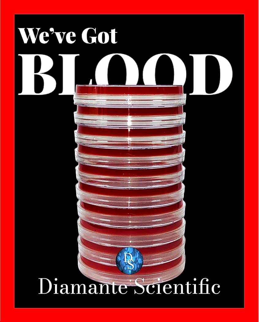 Red Blood Agar (RBA), TSA with 5% Sheep Blood (10-Pack). Pre-Poured, 15x100mm Plates. Used to Detect Hemolysis.
