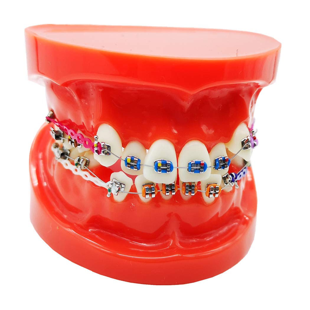 Dental Typodont With Metal Brackets Orthodontic Teeth Model With Ligature Ties Red