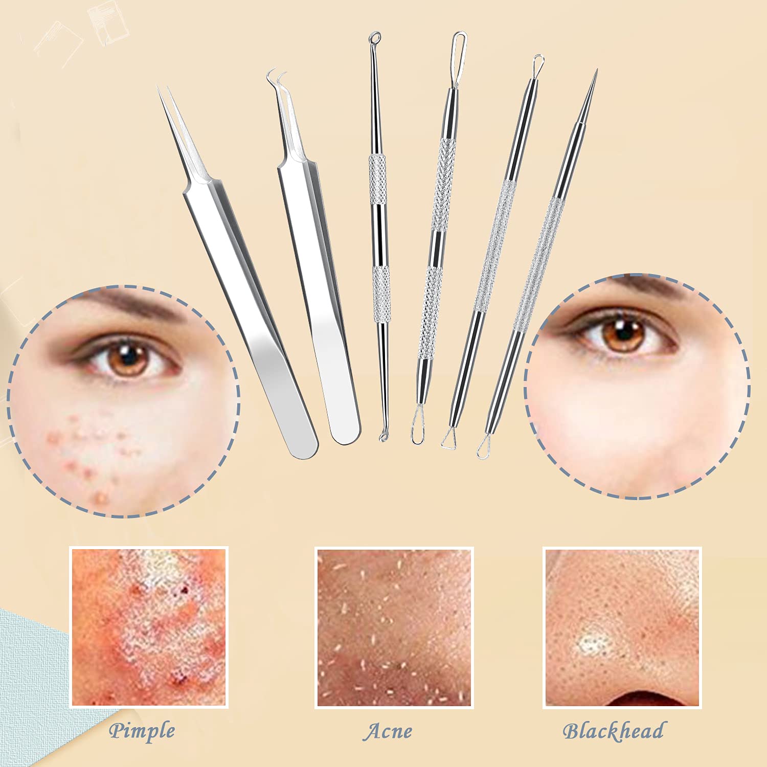 Blackhead Remover Pimple Popper Tool Kit, 6-in-1 Blackhead Comedone Acne Blemish Pimple Extractor Tool Kit Tweezers Kit Skin Care Tools for Face