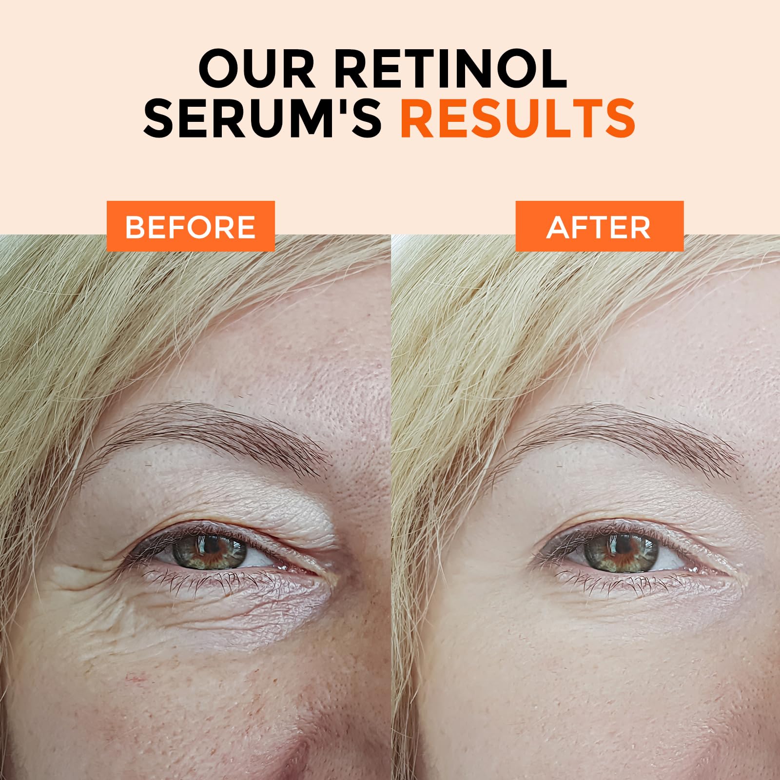 Retinol Serum for Face 2.5%, B5 Resurfacing Retinol Serum with Vitamin C, Vitamin E, Hyaluronic Acid, Niacinamide, Serum for Anti-Aging, Wrinkle Smoothing, Dark Spot Corrector, Brighten Dullness