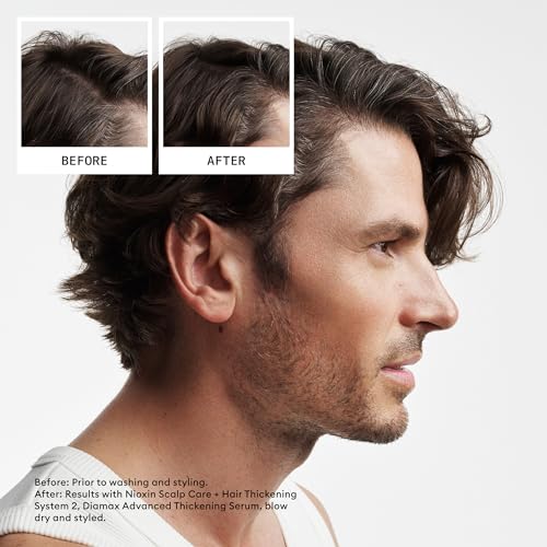 Nioxin System Kit 2 + Thickening Spray, For Natural Hair with Progressed Thinning, Full Size (3 Month Supply)