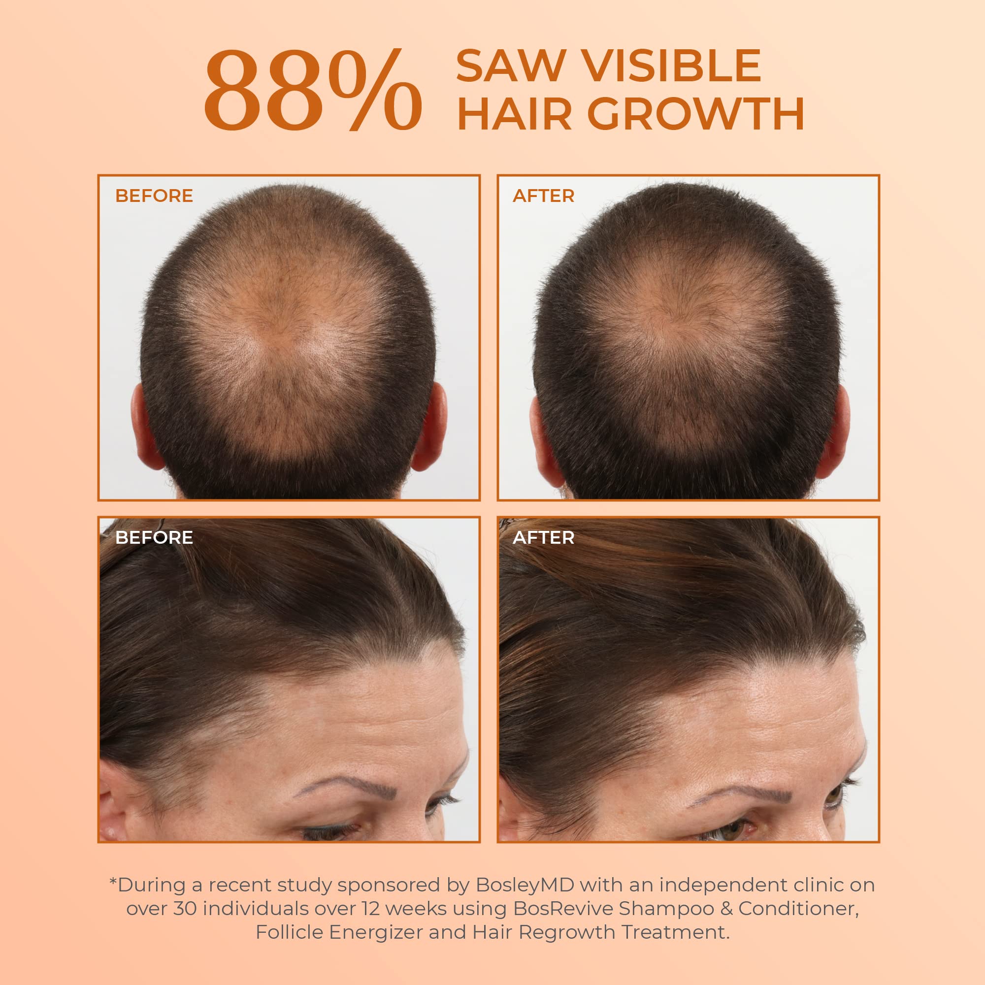 BosleyMD BosRevive Volumizing Conditioner for Noticeably Thinning and Color/Chemically-Treated Hair, 10.1 fl oz.