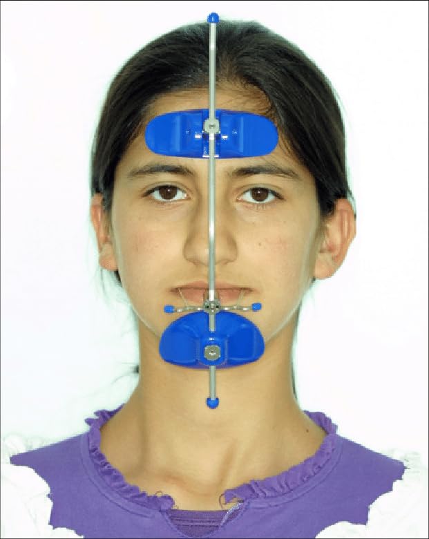 Sino Dental Orthodontic Multi-Adjustable Face Mask High-Pull Reverse Facemask (Blue)