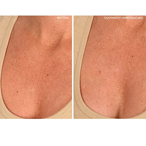 SiO Beauty ChestLift - Chest Anti-Wrinkle Pad 4 Weeks Supply - Overnight Smoothing Silicone Pad For Cleavage & Decollete Skin