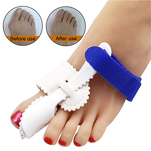 AnHua Valgus Bunion Corrector Orthotics Feet Bone Thumb Adjuster Correction Pedicure Sock Straightener Bunion Splint for Bunions For Crooked Toes Alignment Pain Relief (Style2:Blue white)