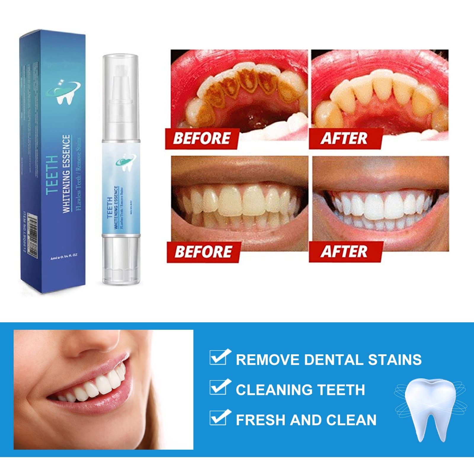 3Pcs Teeth Whitening Pen,Teeth Whitening Gel,Teeth Whitening Essence Pen,Intensive Teeth Stain Remover,Reduce Yellowing Oral Care for Women & Men.