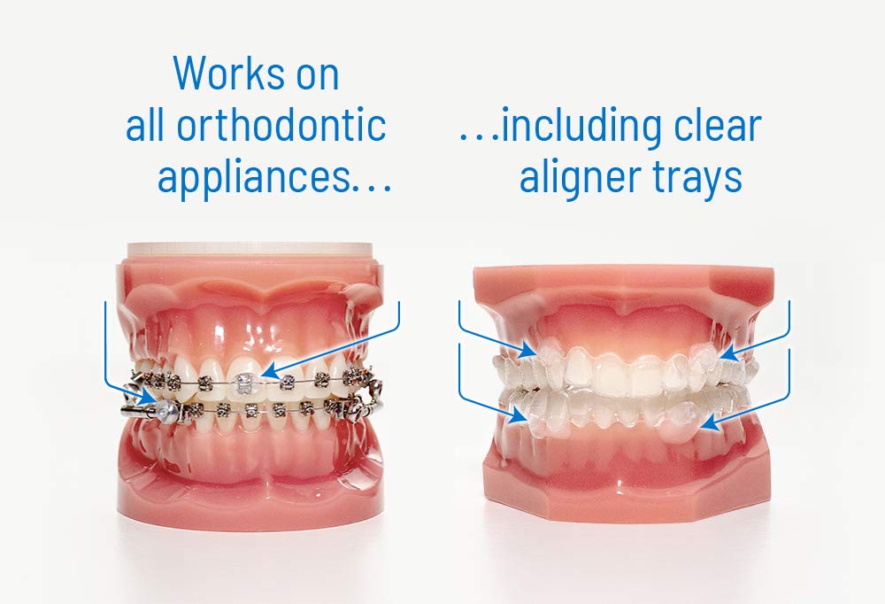 OrthoDots CLEAR β Moisture Activated Braces Wax Alternative for Pain Caused by Braces, Clear Aligner Trays, and Other Orthodontic Appliances. OrthoDots Stick Better and Stay on Longer than Dental Wax.