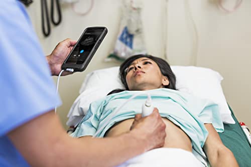 Philips Lumify C5-2 Curved Array Transducer, Portable Ultrasound Solution