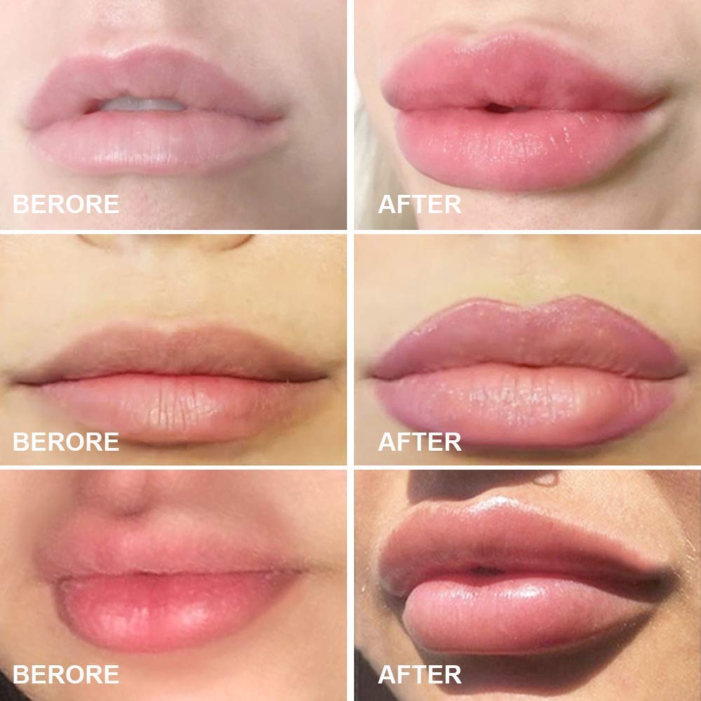 MonLiya Lips Enhancer Plumper Device Lips Silicone Fish Shape Natural Pout Mouth Tool Sexy Lip Mouth