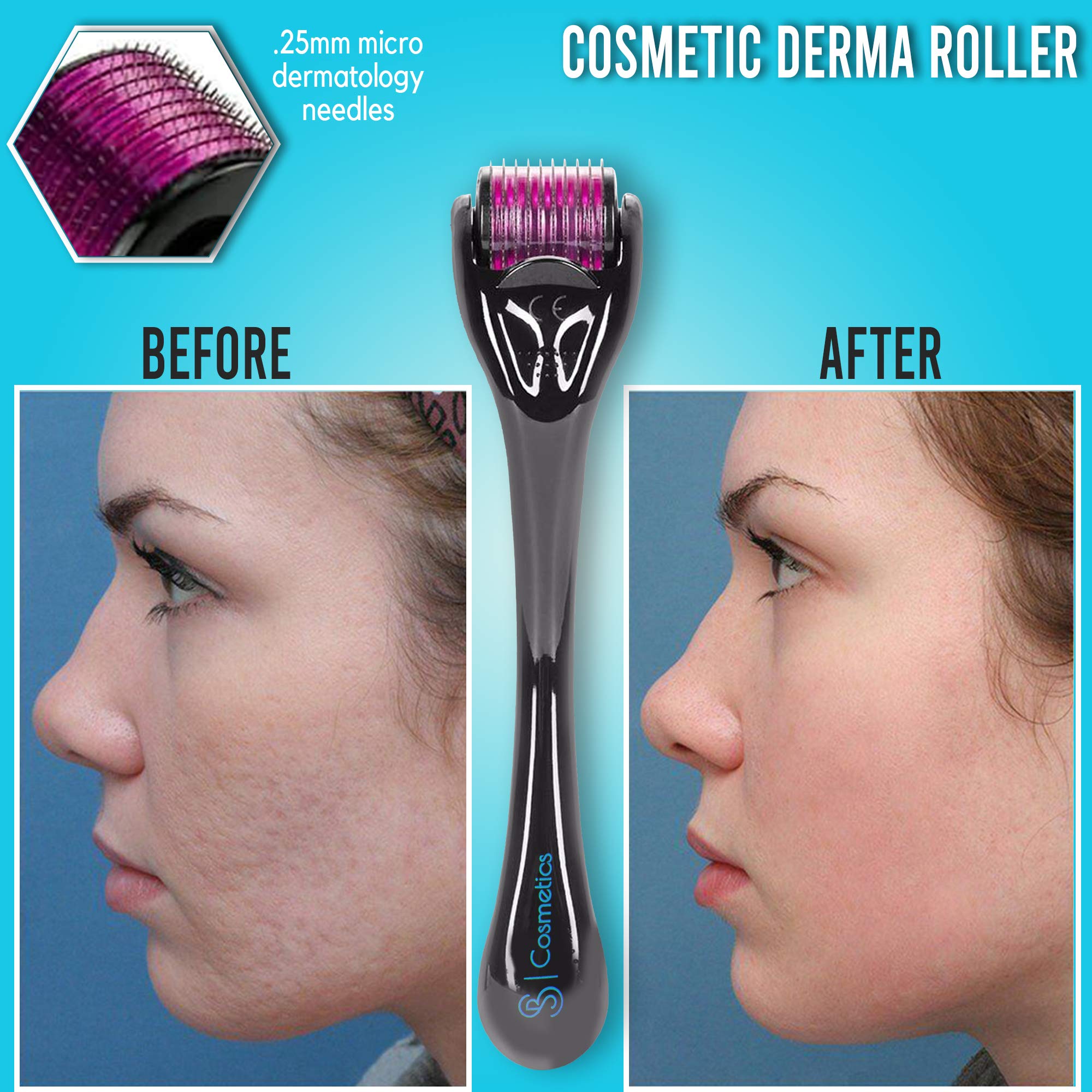 SB Cosmetics- Derma Roller-Best Premium Beard Face Scalp & Body Cosmetic Micro Needle Skin Care Beauty System .25mm 540 Titanium Reusable