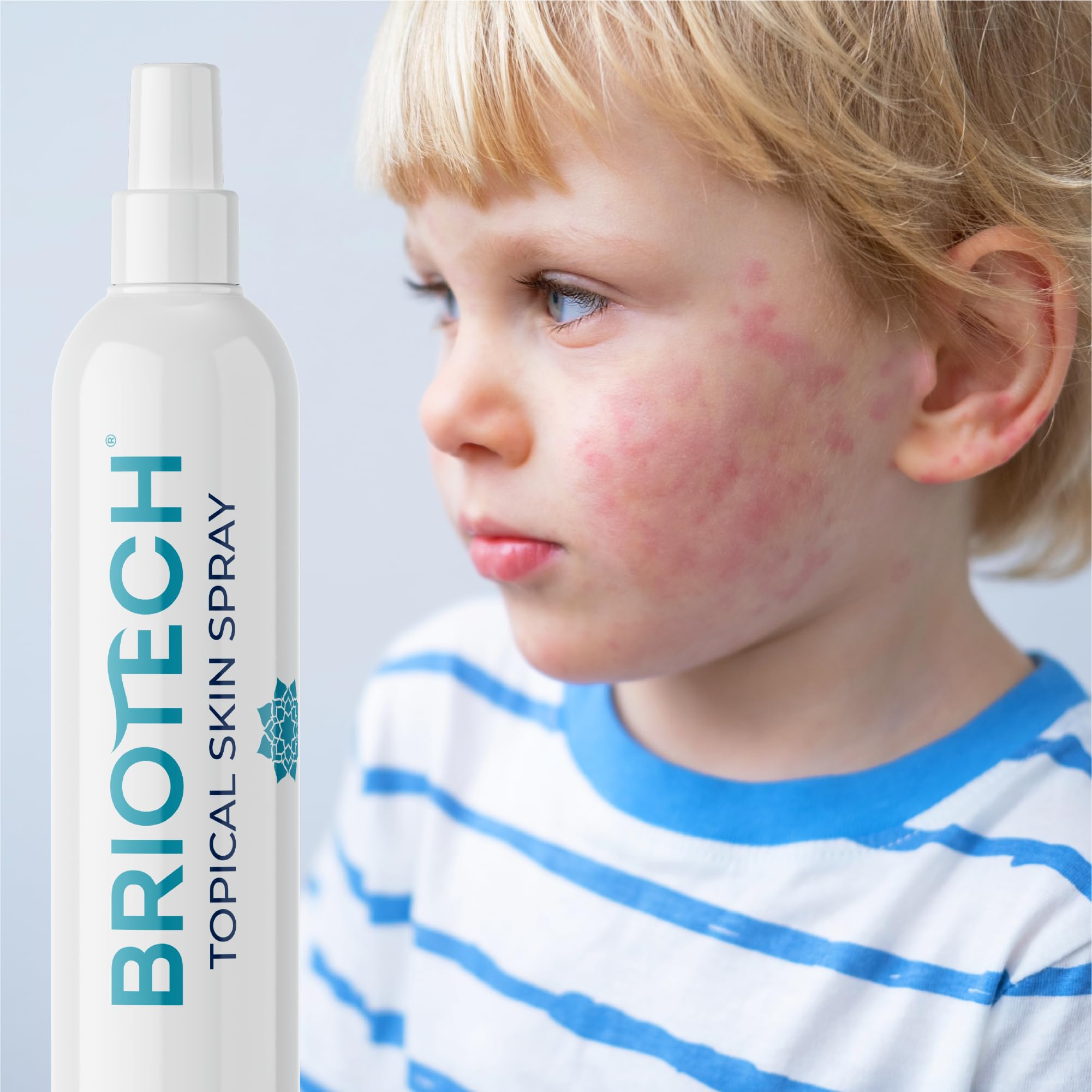 BRIOTECH Topical Skin Spray, Hypochlorous Acid Spray for Body & Face, Eyelid Cleanser, HOCl Facial Mist, Support Against Irritation and Redness, Stocking Stuffers, Packaging May Vary, 4 oz, 1 ct