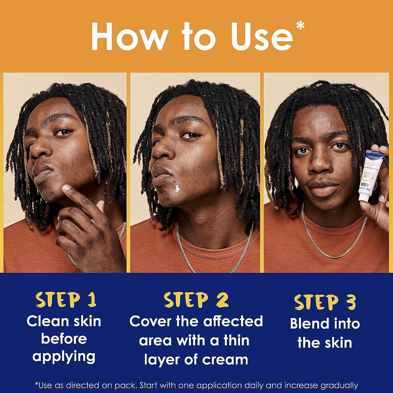 Clearasil Stubborn Acne Control 5in1 Spot Treatment Cream, Maximum Strength, Benzoyl Peroxide Acne Medication, Fights Blocked Pores, Pimple Size, Excess Oil, Acne Marks & Blackheads, 1 oz (Pack of 4)
