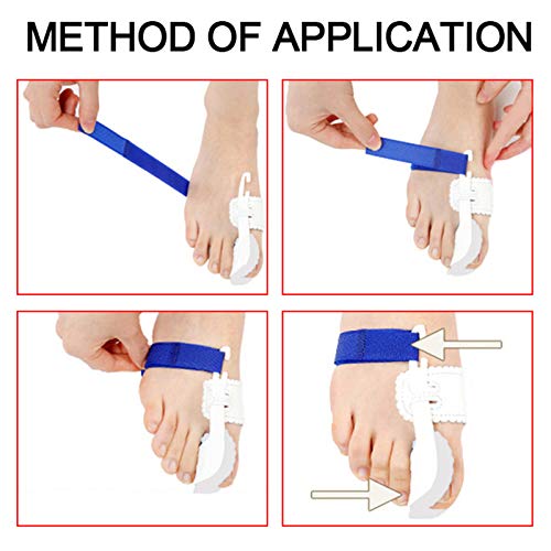 AnHua Valgus Bunion Corrector Orthotics Feet Bone Thumb Adjuster Correction Pedicure Sock Straightener Bunion Splint for Bunions For Crooked Toes Alignment Pain Relief (Style2:Blue white)