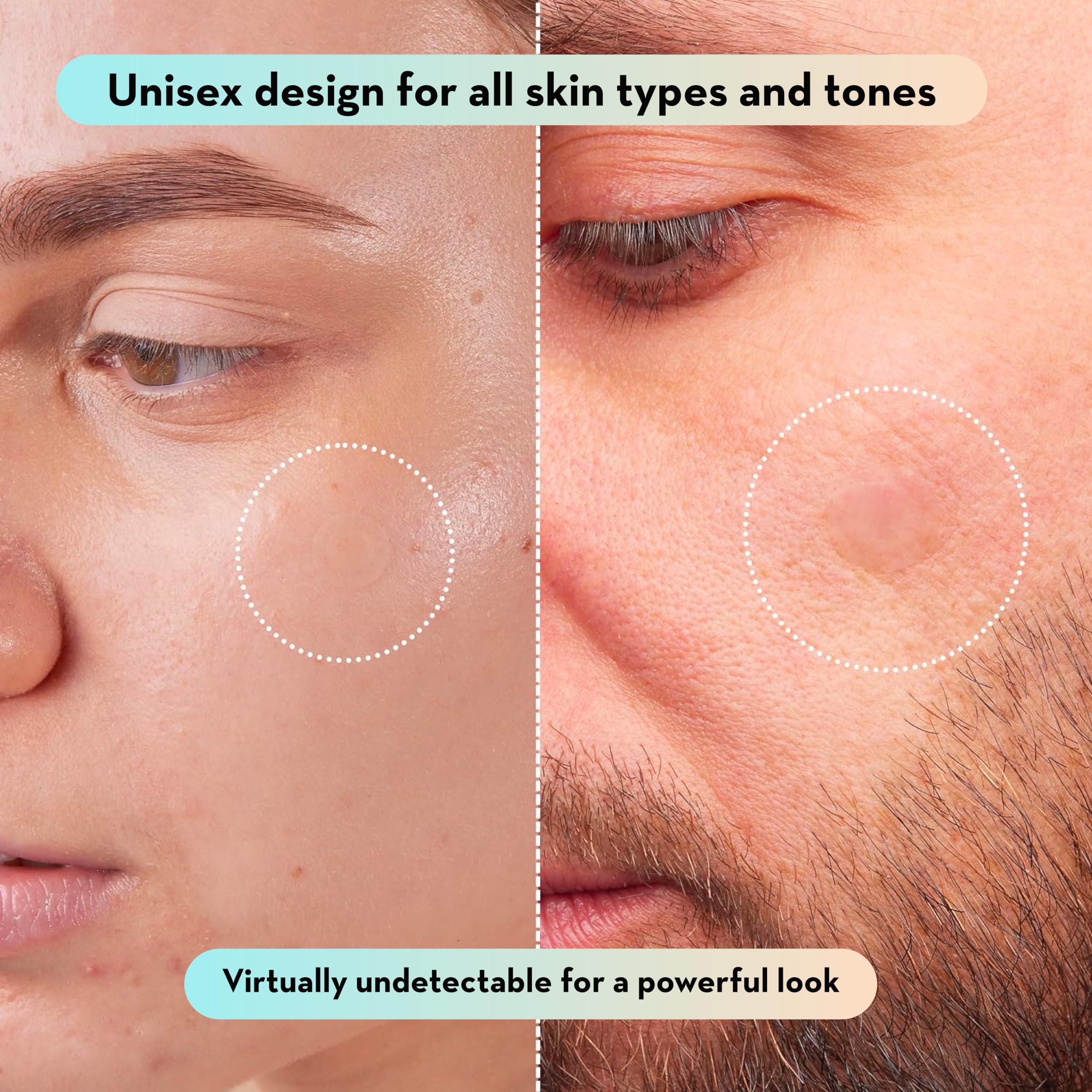 LE GUSHE Korean Pimple Patches for Face (132 Dots) - Hydrocolloid Acne Patches with Tea Tree Oil - Invisible Zit Stickers - Dermatologist Tested - Korean Skin Care