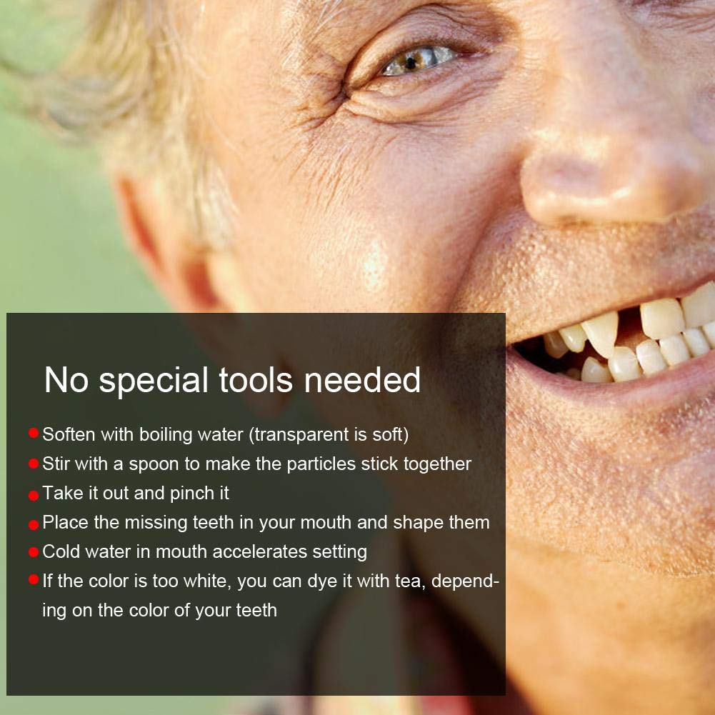 Teeth Repair Beads for Missing Tooth Filling Material with Broken Teeth, Multifunction Teeth Repair Set Plastic(10g)