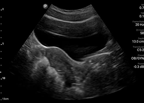 Philips Lumify C5-2 Curved Array Transducer, Portable Ultrasound Solution