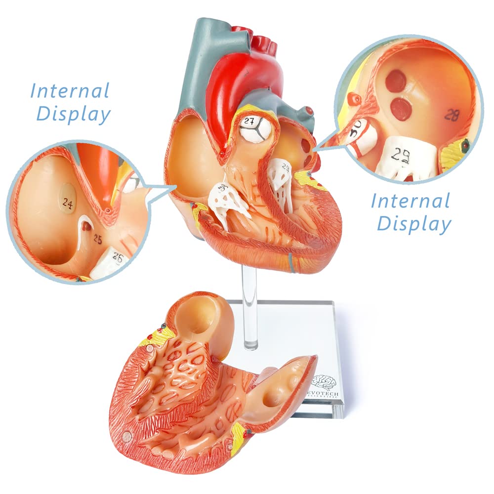 EVOTECH SCIENTIFIC Human Heart Model For Anatomy, 2 - Part Heart Models Anatomy Life Size Medical Heart Model for Classroom and Cardiology Study