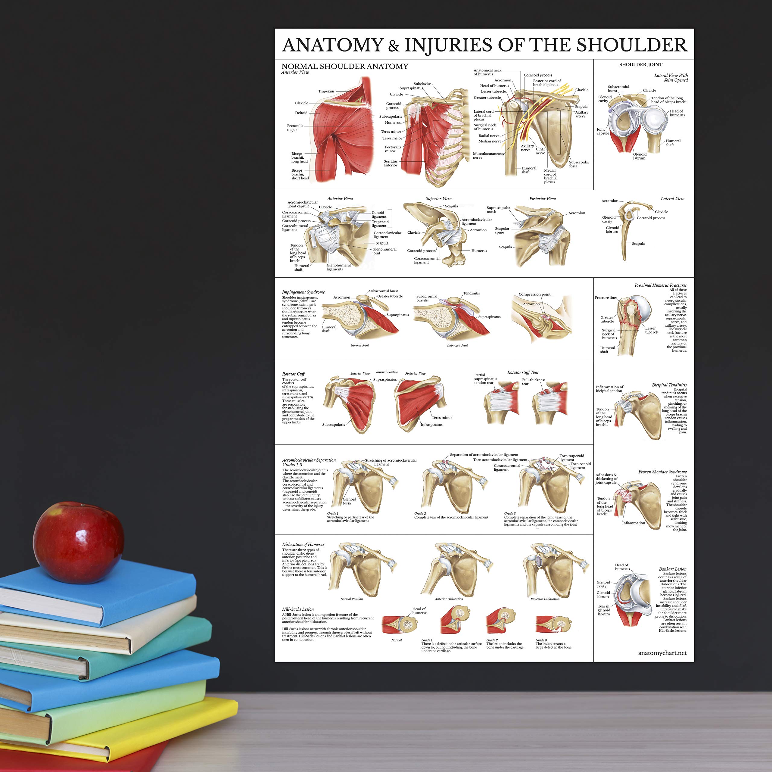 Palace Learning 2 Pack - Anatomy and Injuries of The Knee & Shoulder Poster Set - Anatomical Chart Set - Laminated 18" x 24"