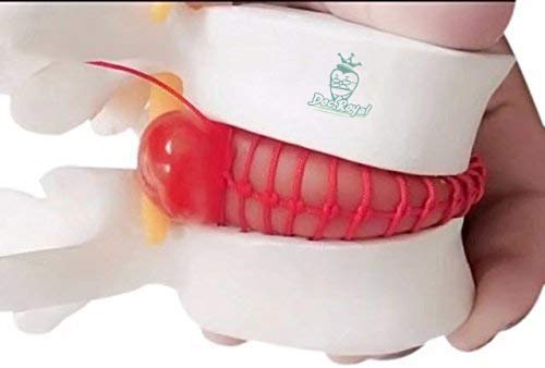 Doc.Royal Anatomical Human Lumbar Vertebrae Degenerative Lumbar Human Spine Model 1PCS