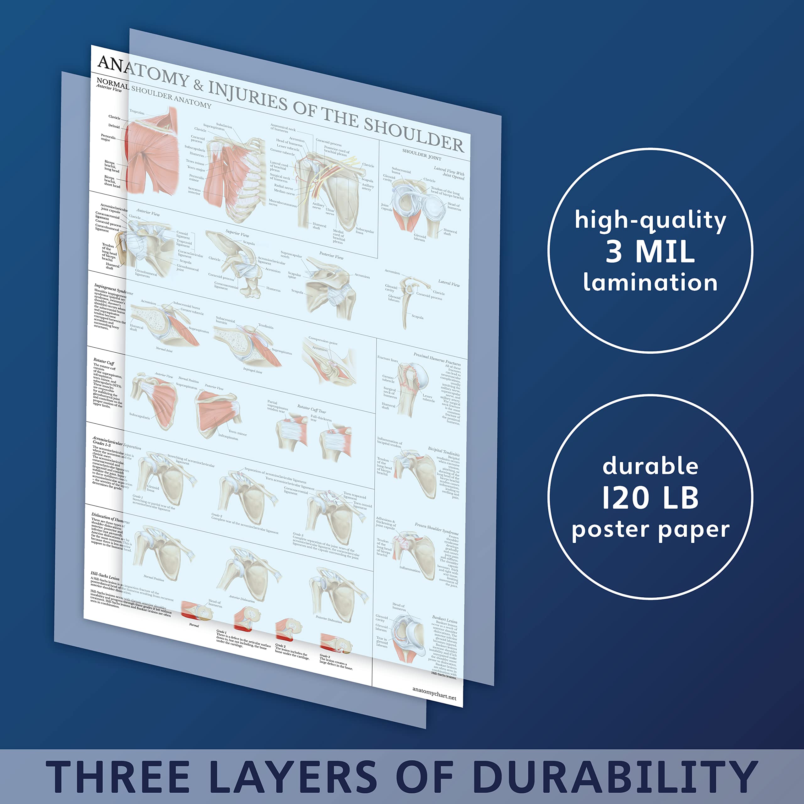 Palace Learning 2 Pack - Anatomy and Injuries of The Shoulder & Hip Poster Set - Anatomical Chart Set - Laminated 18" x 24"