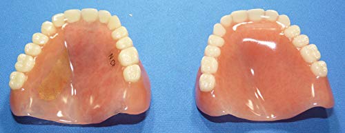 Denture Repair Lab - Duplicate Denture - Denture Clone - Denture Duplication - New Denture - Copy Denture - Spare Denture - Denture Clone - Denture Teeth Repair