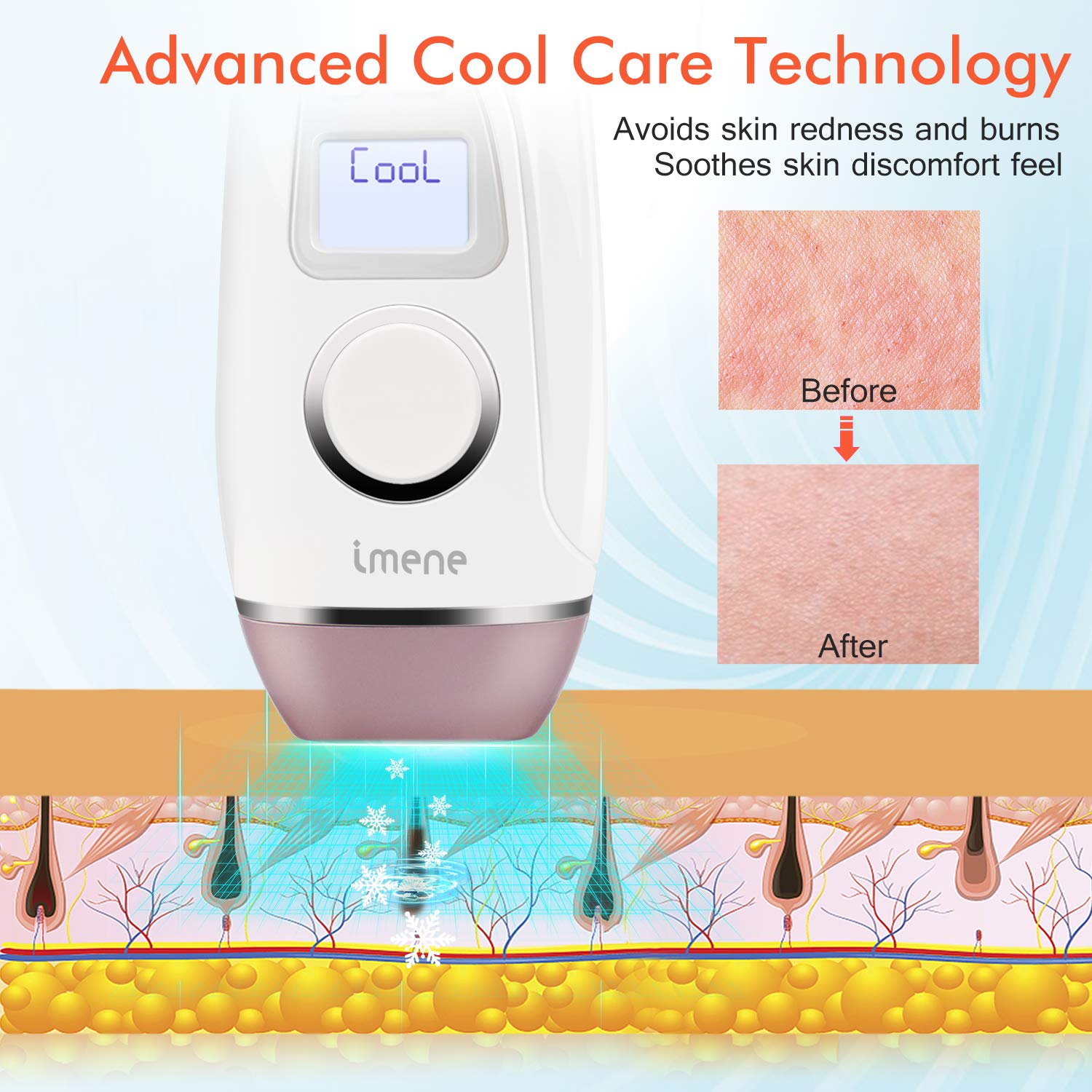IMENE Permanent Hair Removal Machine for Women & Men, 500,000 Flashes IPL Hair Removal System with Ice Care Function for Full Body Home Use Hair Removal-Safest and Fastest IPL Technology