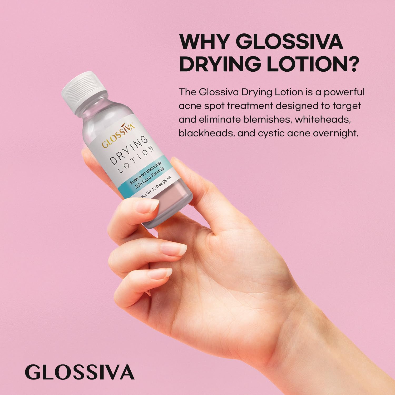 Glossiva Drying Lotion – Acne Spot Treatment, Blemish & Pimple Drying Solution with Overnight Results – 1.23 Fl Oz