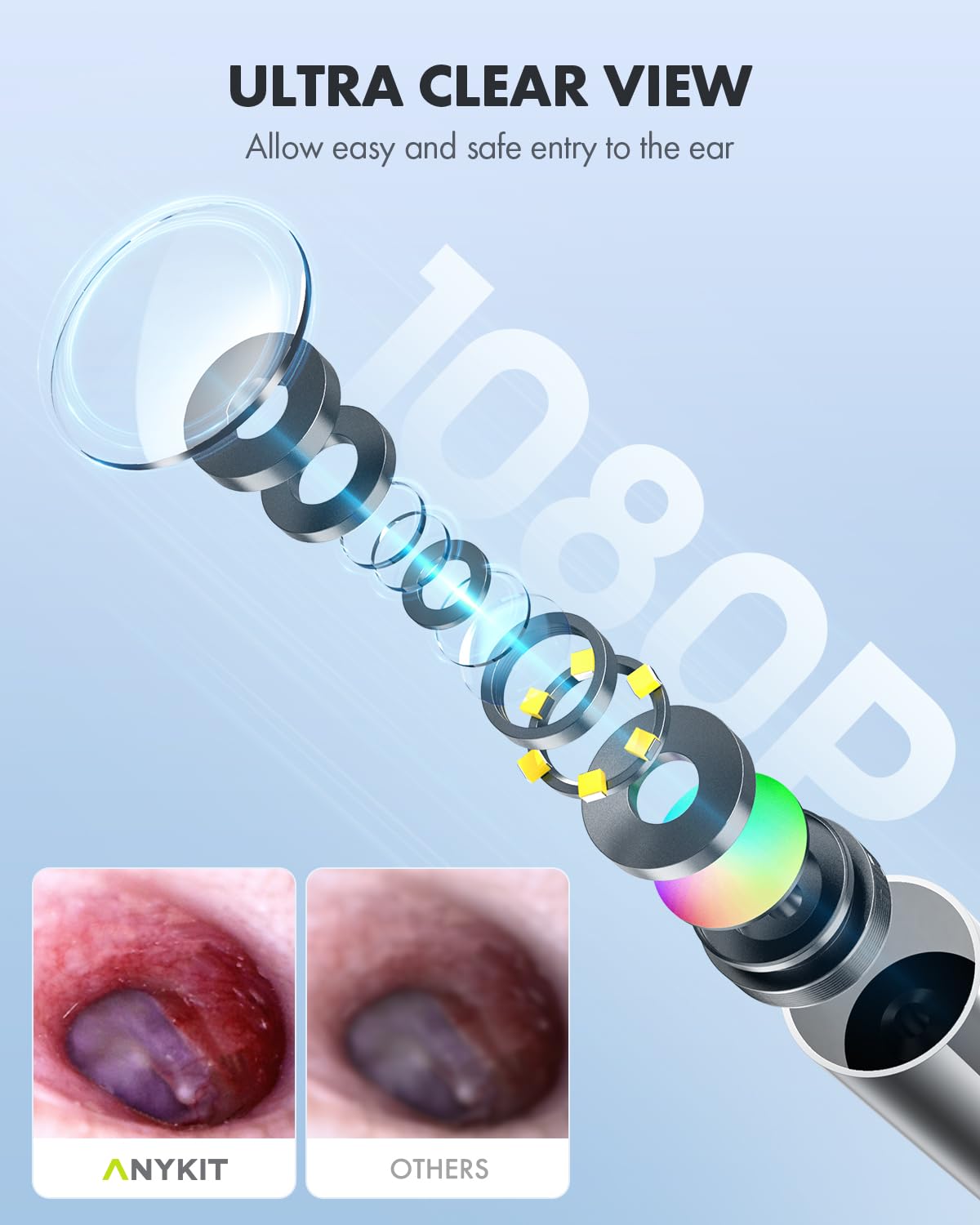 Anykit Ear Wax Removal Tool, Ultra Clear View Ear Scope with LED Lights for Ear Cleaning, Ear Cleaner Camera Otoscope with Ear Spoon & Specula for Phone & Tablet