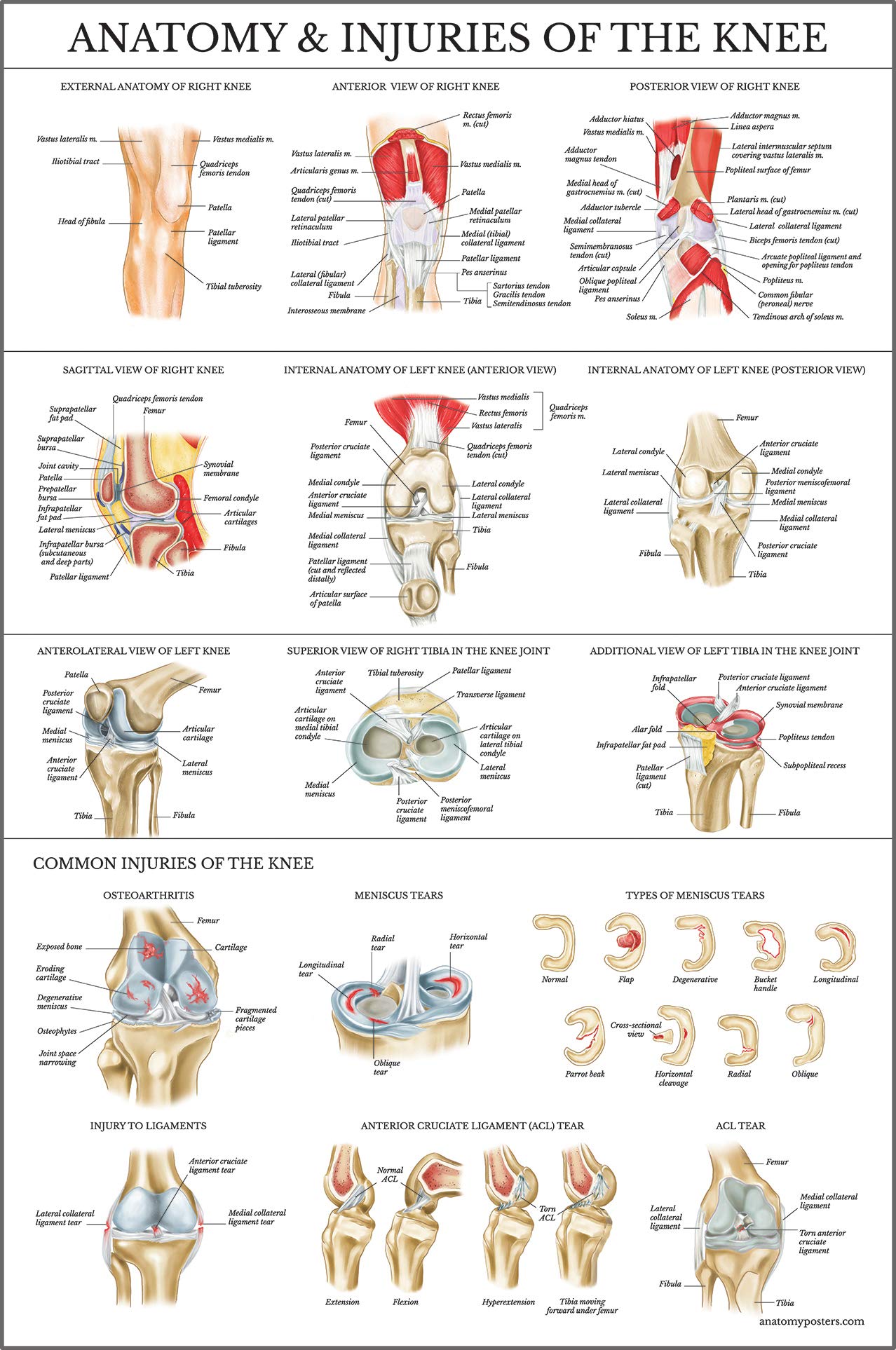 Palace Learning 2 Pack - Anatomy and Injuries of The Knee & Hip Poster Set - Anatomical Chart Set - Laminated 18" x 24"
